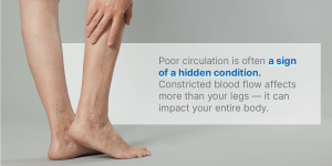 Poor Circulation & Vascular Pain: Causes & Treatment